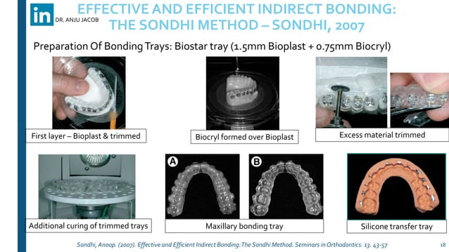 Indirect Bonding in Orthodontics | PPTX