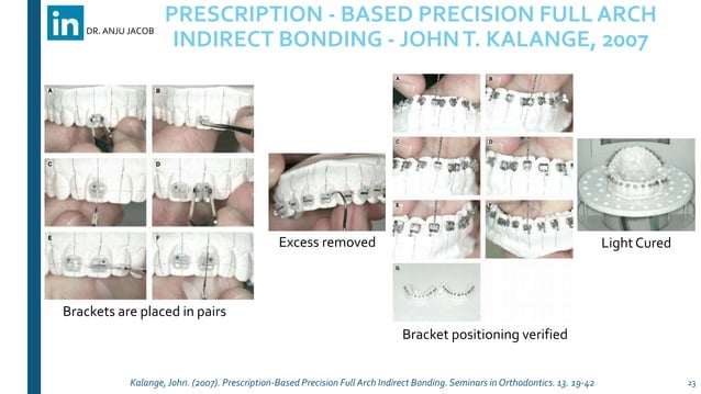 Indirect Bonding in Orthodontics | PPTX