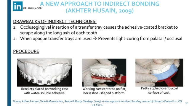 Indirect Bonding in Orthodontics | PPTX