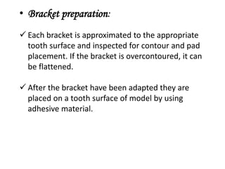 Indirect bonding in lingual orthodontics parag | PPTX