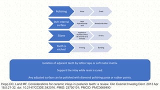 indirect inlay restoration.pptx