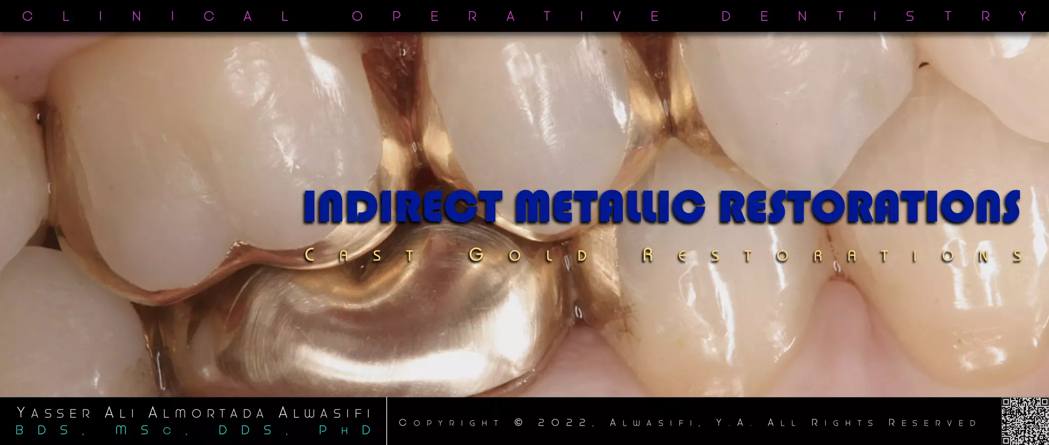 Indirect Metallic Restoration-2022.pdf