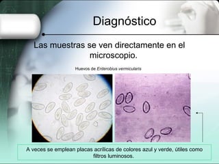 Test de Graham | PPT