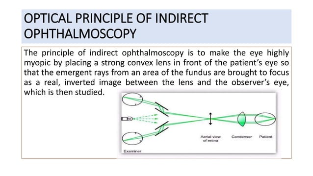 INDIRECT OPHTHALMOSCOPE.pptx