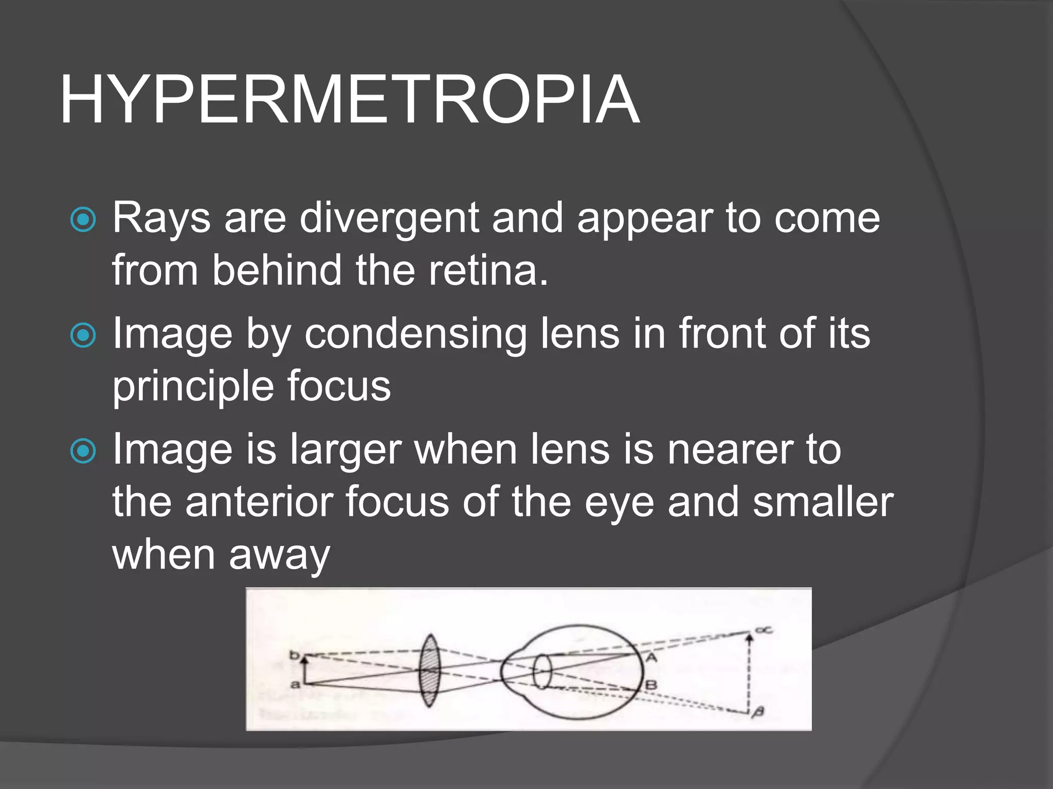 Indirect ophthalmoscopy | PPTX
