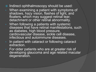Indirect ophthalmoscopy | PPTX