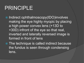 Indirect ophthalmoscopy | PPTX