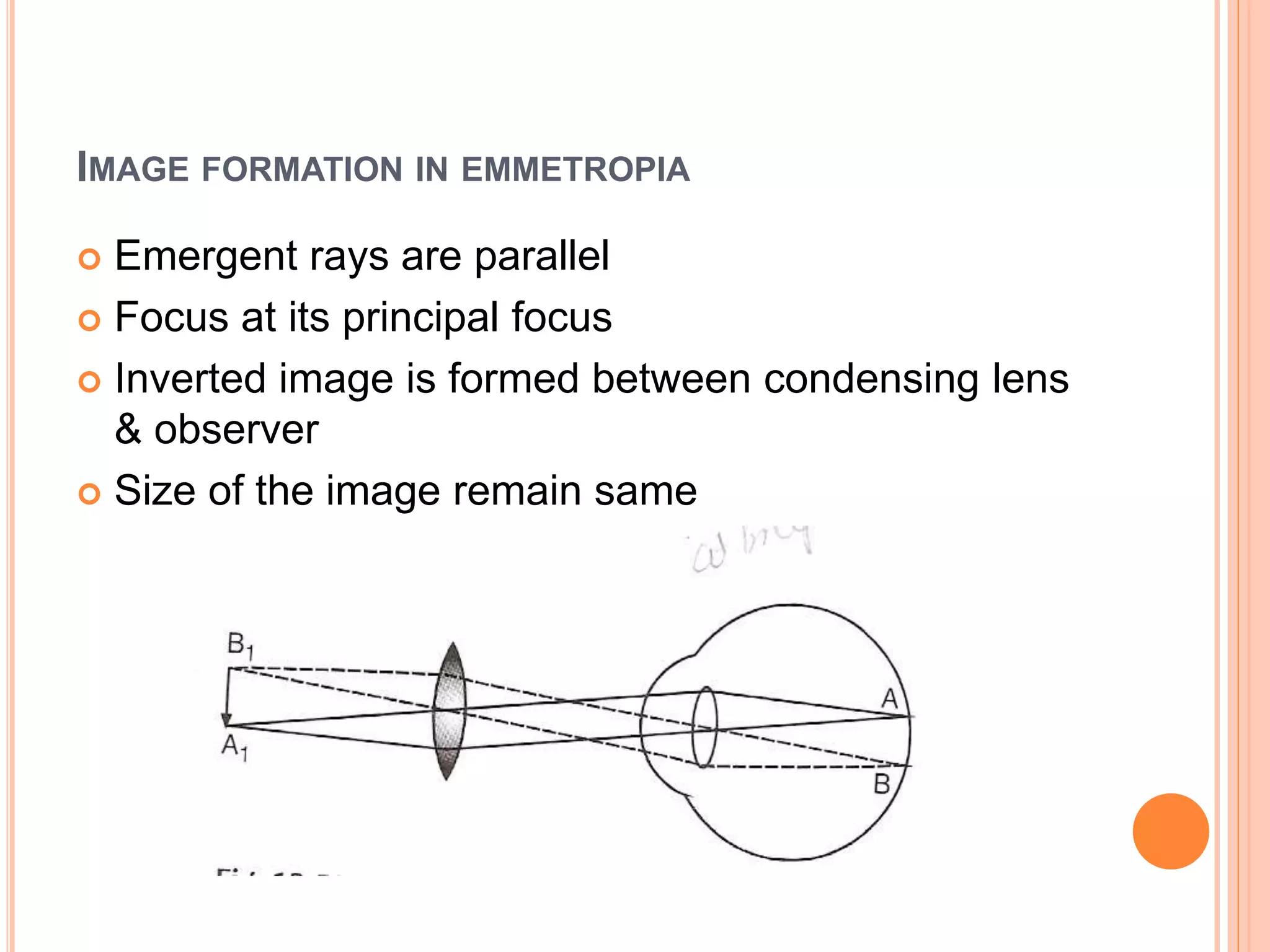 Indirect ophthalmoscopy | PPT