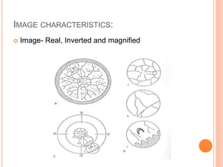 Indirect ophthalmoscopy | PPT