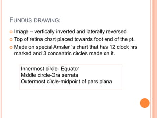 Indirect ophthalmoscopy | PPT
