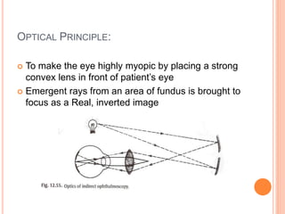 Indirect ophthalmoscopy | PPT