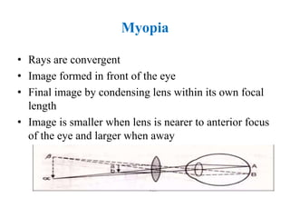Indirect Ophthalmoscopy .pptx