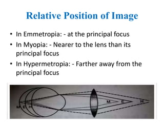 Indirect Ophthalmoscopy .pptx