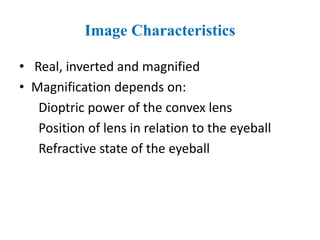 Indirect Ophthalmoscopy .pptx