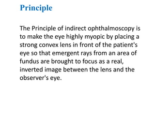 Indirect Ophthalmoscopy .pptx