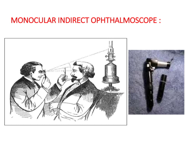 Indirect ophthalmoscopy | PPTX | Eye and Vision Conditions | Diseases ...