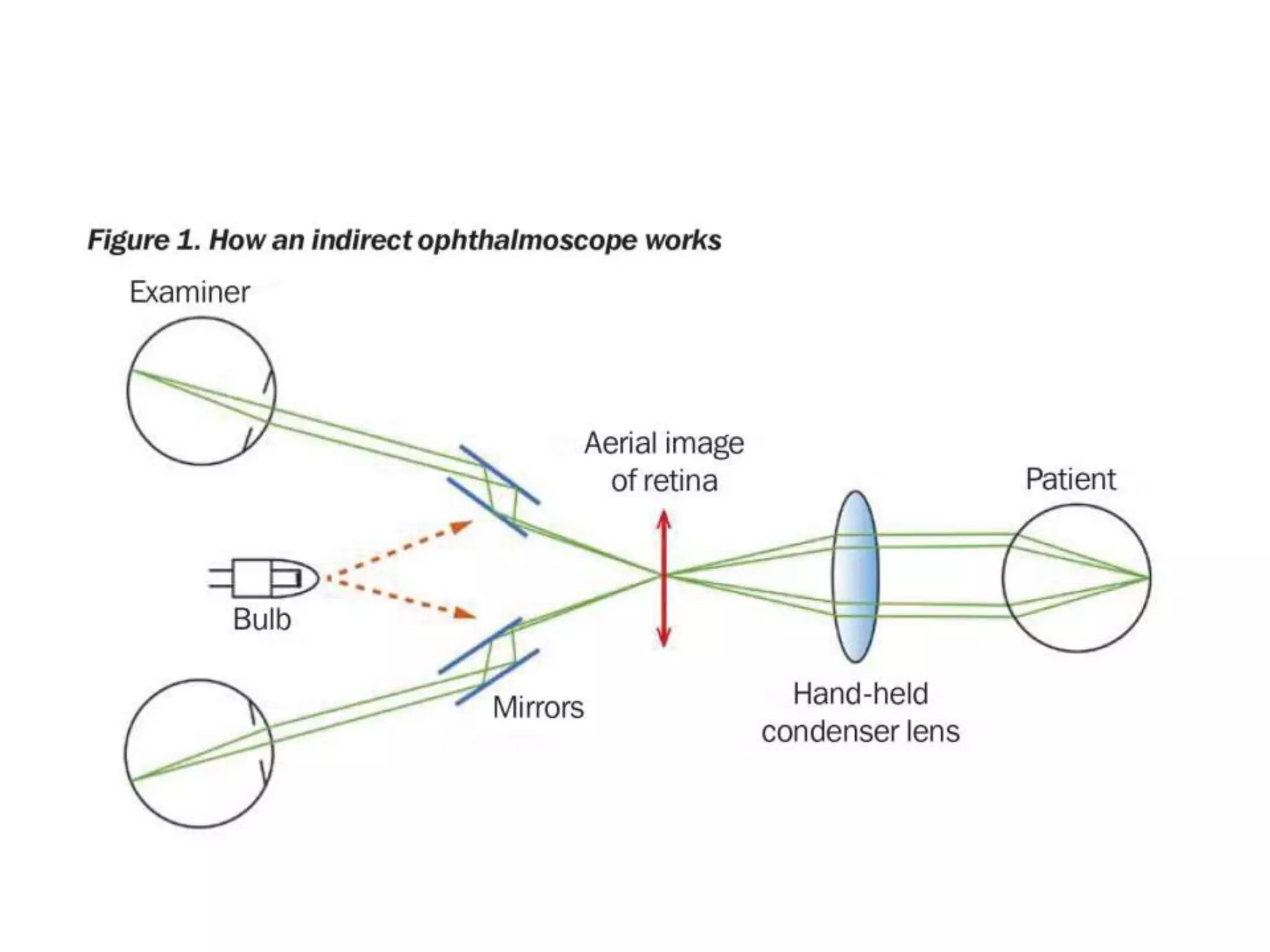 INDIRECT OPHTHALMOSCOPY ppt | PPTX