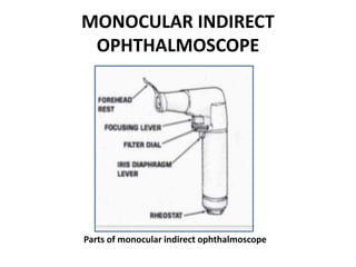 Monocular Indirect Ophthalmoscope