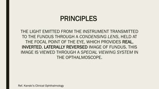 Insights of Indirect Opthalmoscopy in field of Optometry | PPTX