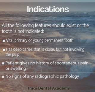 Indirect Pulp Capping Procedure | PDF