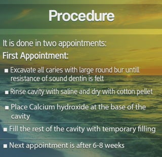 Indirect Pulp Capping Procedure | PDF