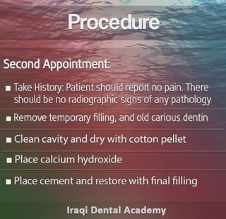 Indirect Pulp Capping Procedure | PDF