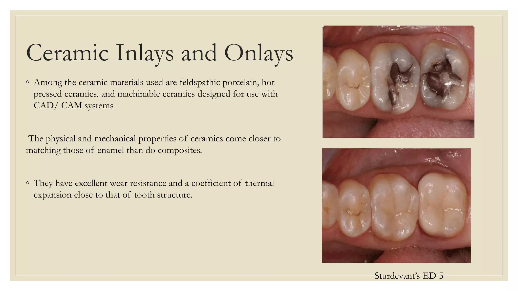 INDIRECT RESTORATIONS.pptx