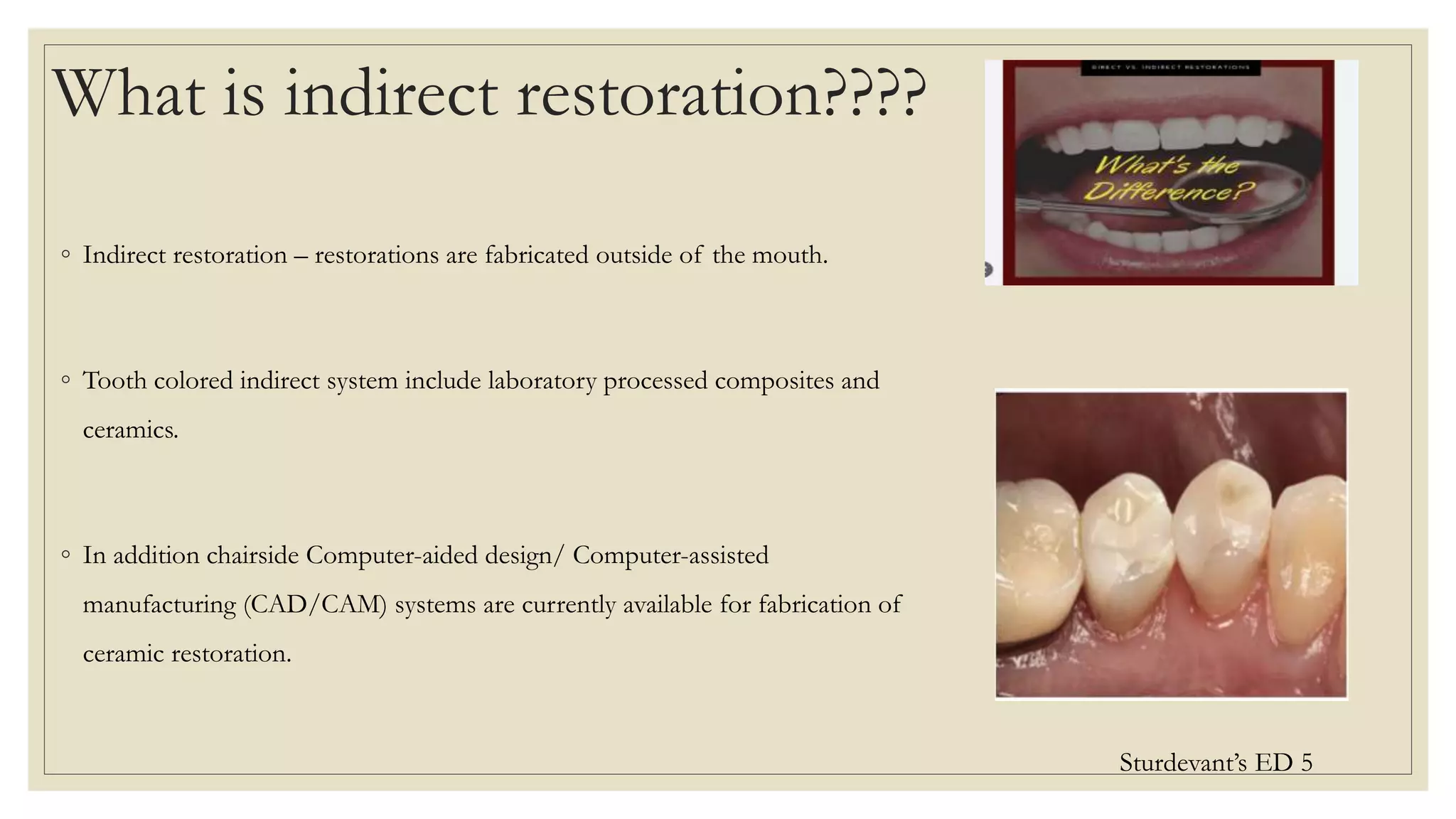 INDIRECT RESTORATIONS.pptx