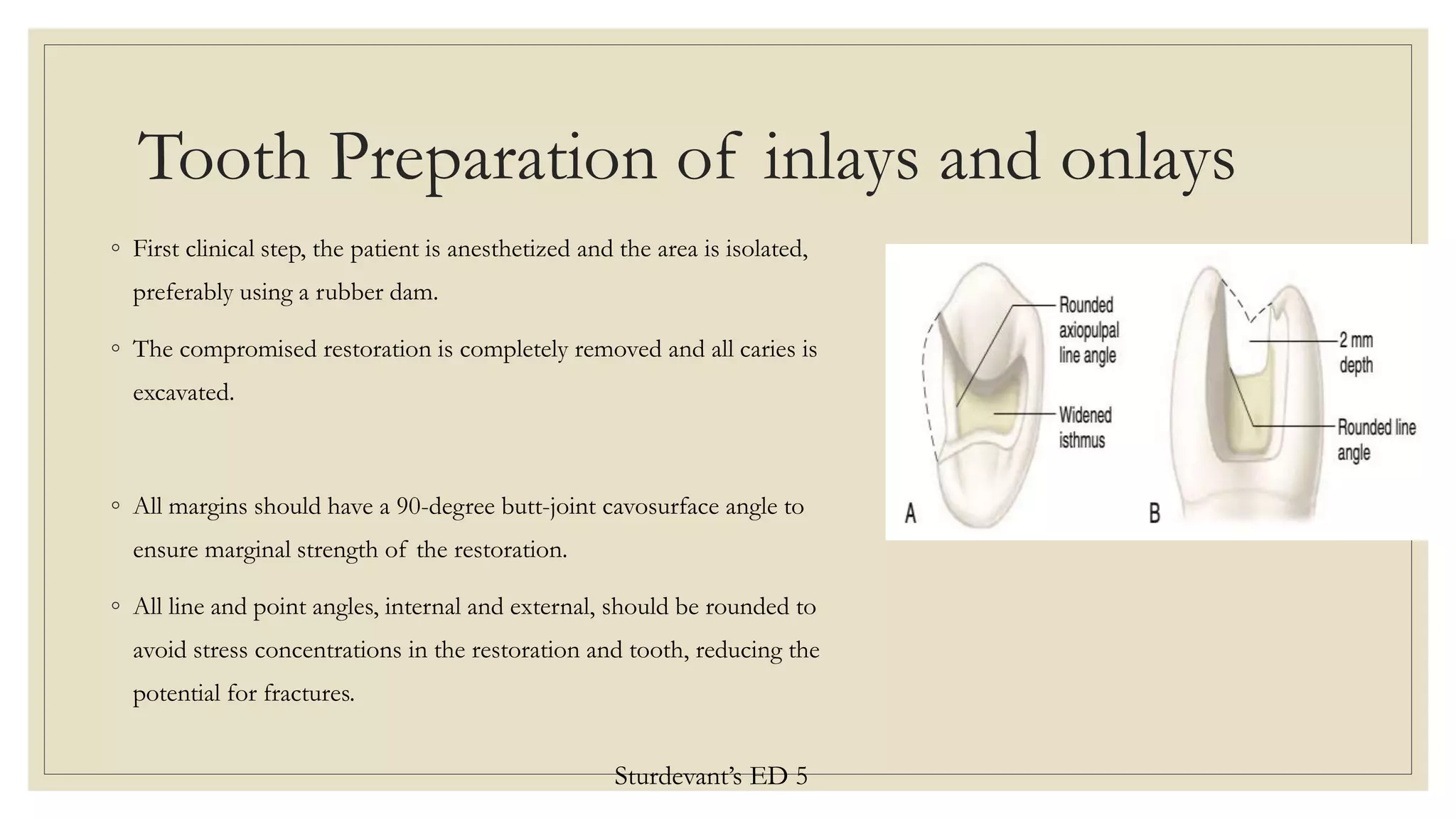 INDIRECT RESTORATIONS.pptx
