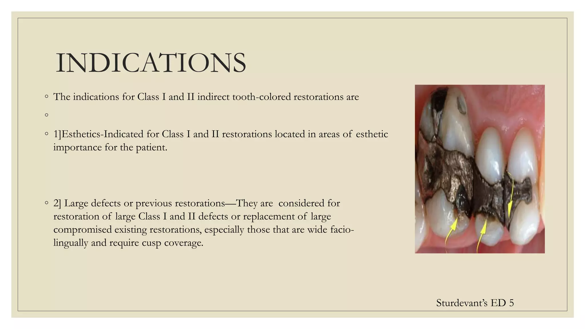 INDIRECT RESTORATIONS.pptx