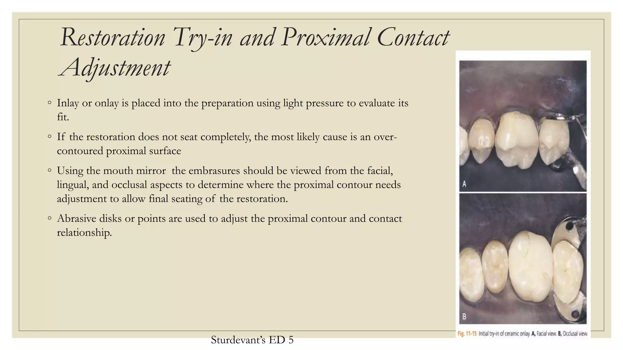 INDIRECT RESTORATIONS.pptx