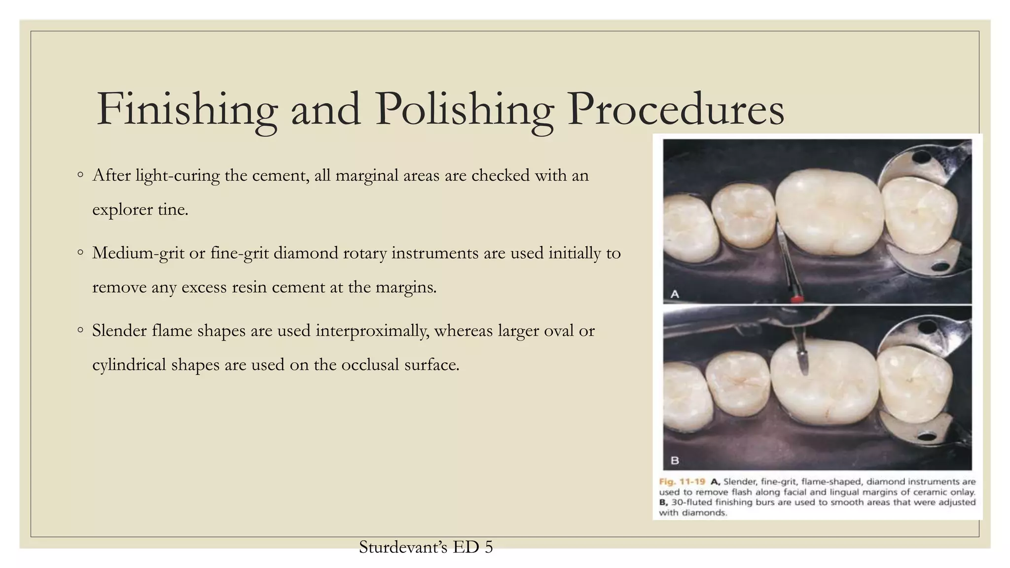 INDIRECT RESTORATIONS.pptx