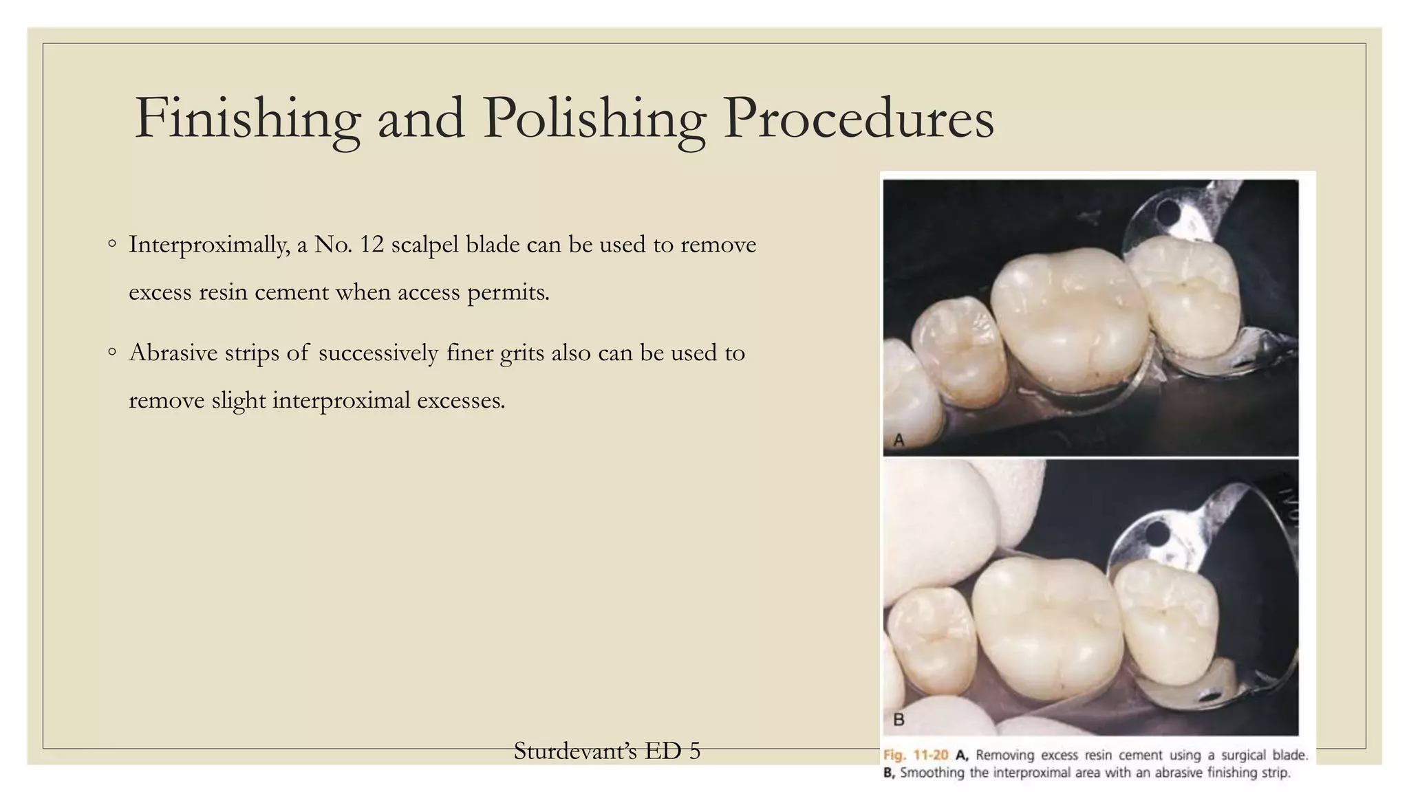 INDIRECT RESTORATIONS.pptx