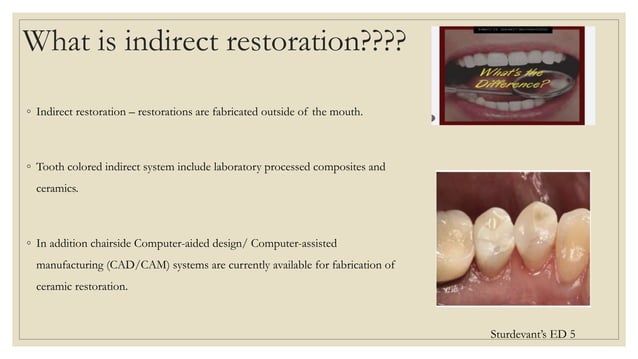INDIRECT RESTORATIONS.pptx