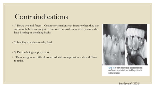 INDIRECT RESTORATIONS.pptx
