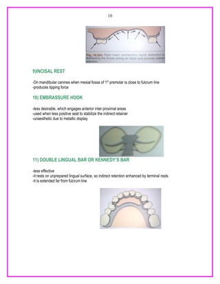 Indirect Retainer | DOC