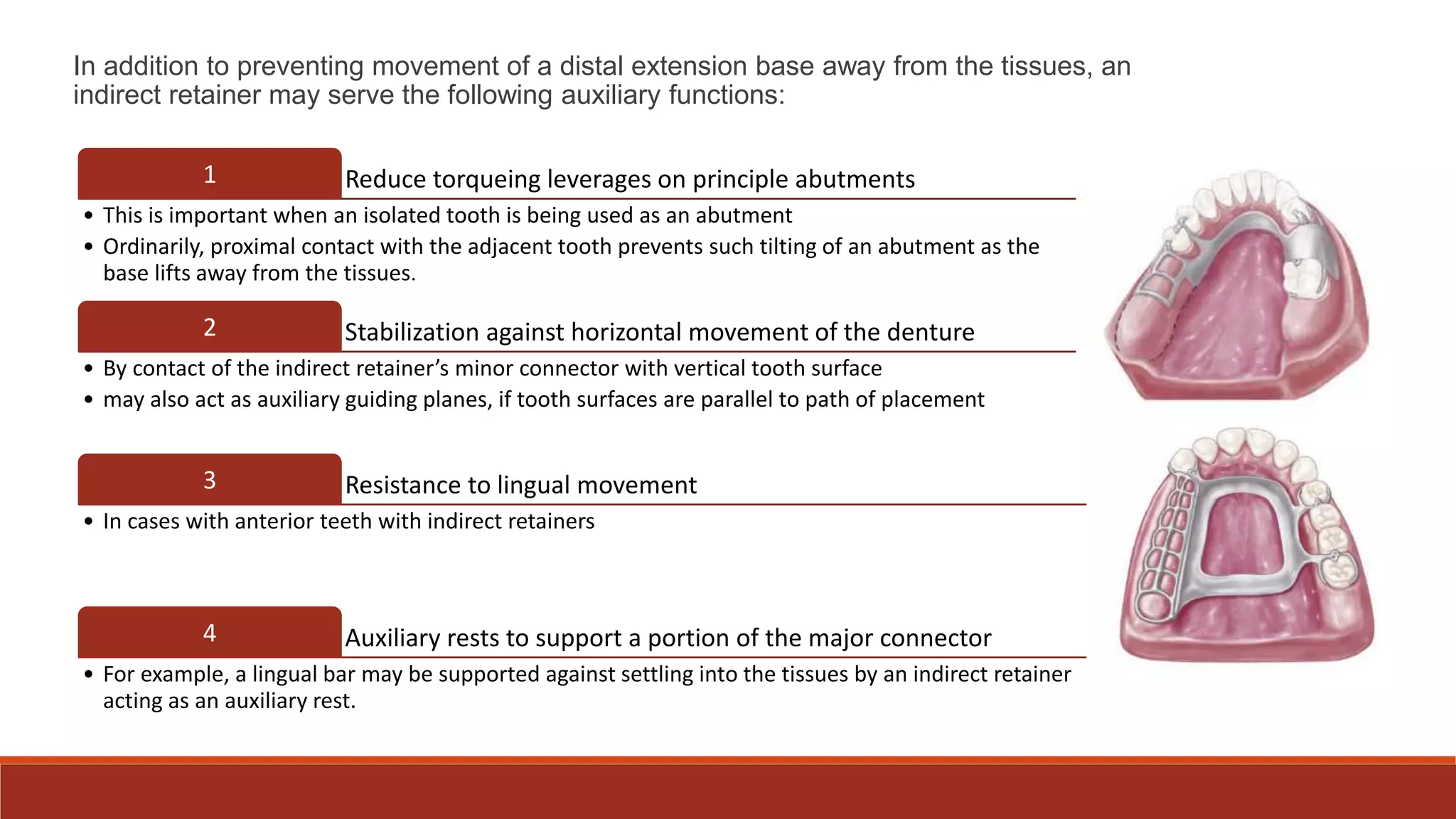 INDIRECT RETAINERS IN CAST PARTIAL DENTURES | PPTX