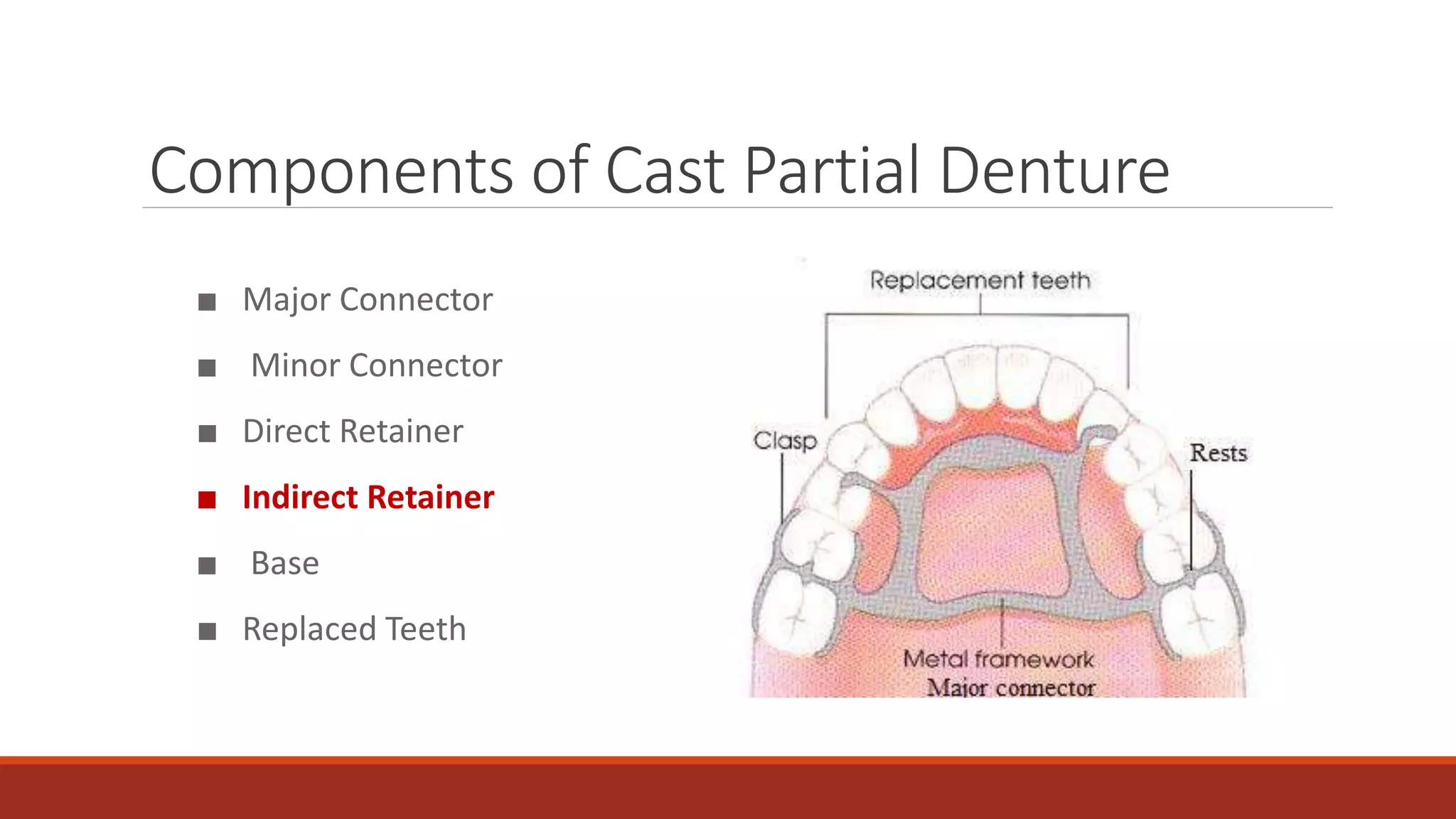 INDIRECT RETAINERS IN CAST PARTIAL DENTURES | PPTX