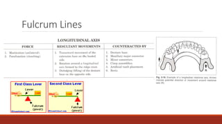INDIRECT RETAINERS IN CAST PARTIAL DENTURES | PPTX