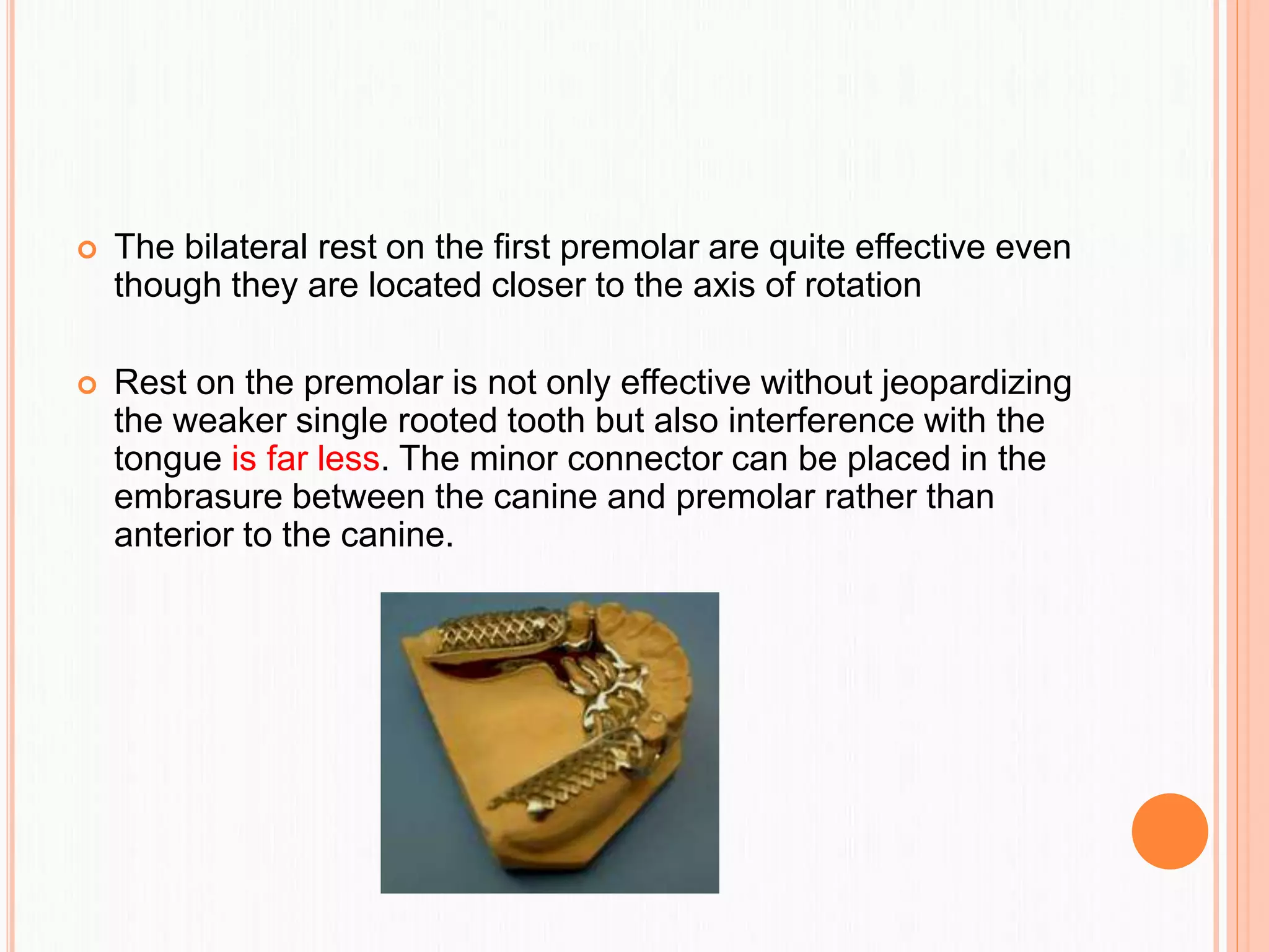 INDIRECT RETAINERS.ppt