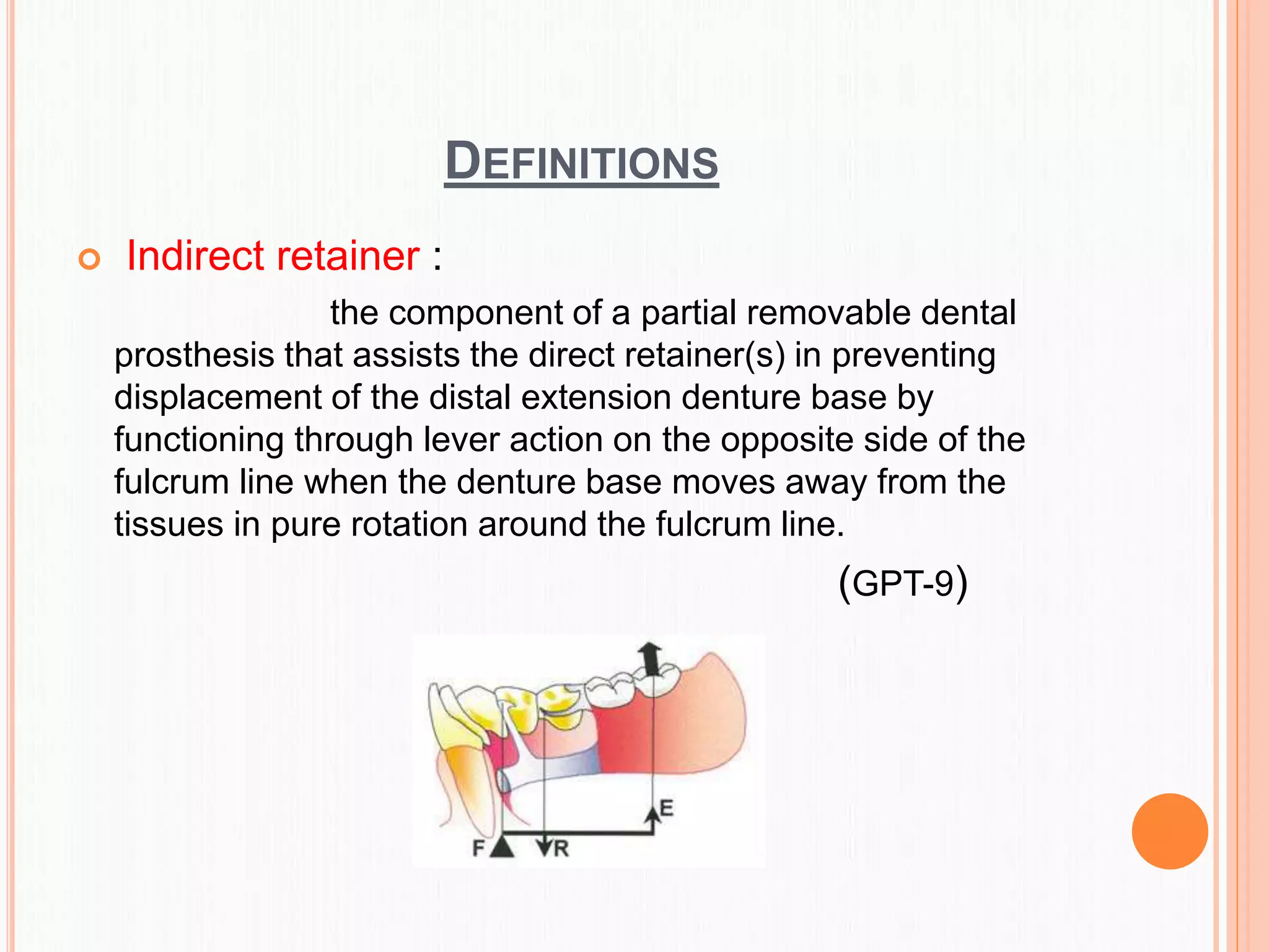 INDIRECT RETAINERS.ppt
