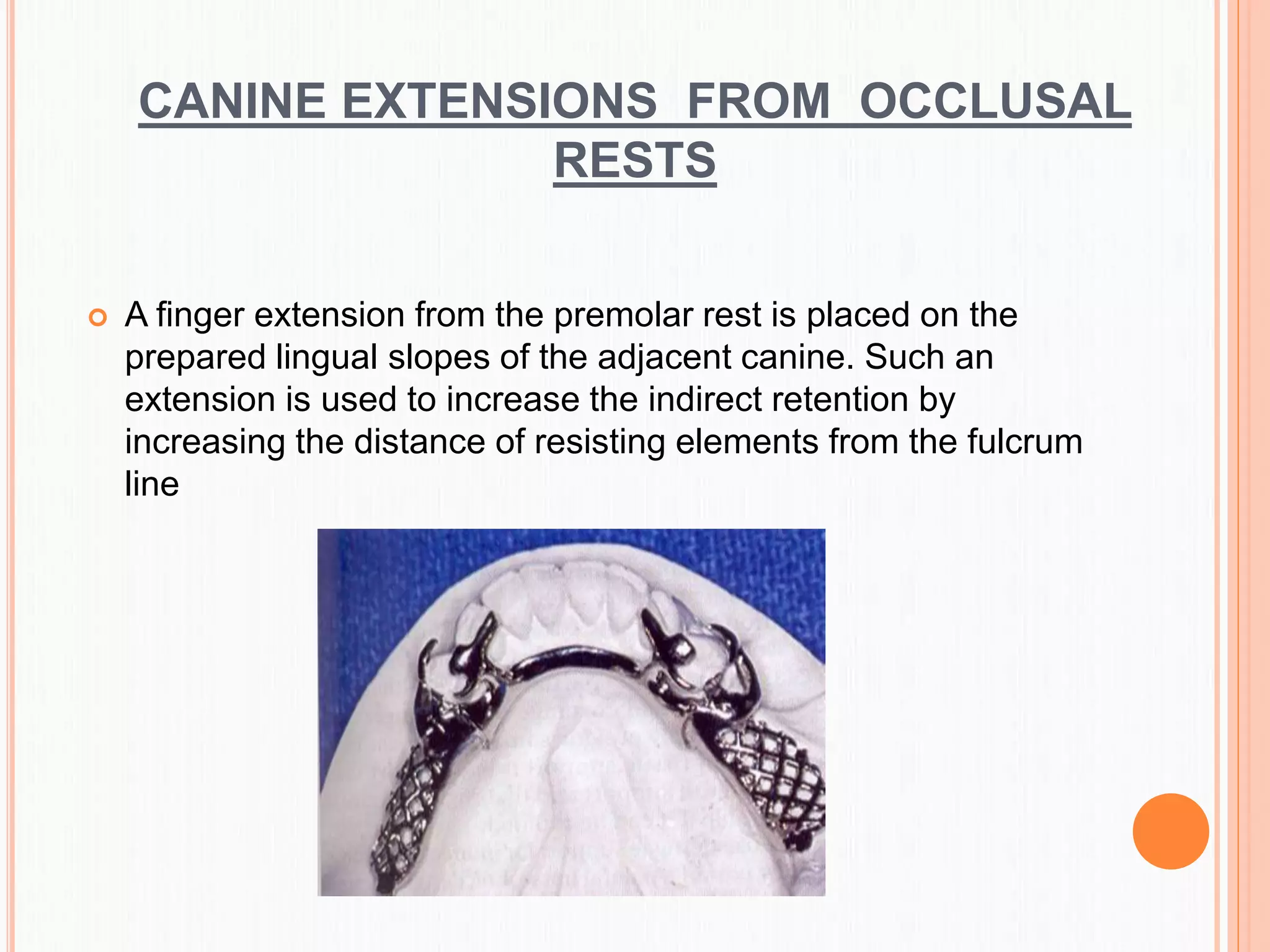 INDIRECT RETAINERS.ppt