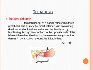 INDIRECT RETAINERS.ppt