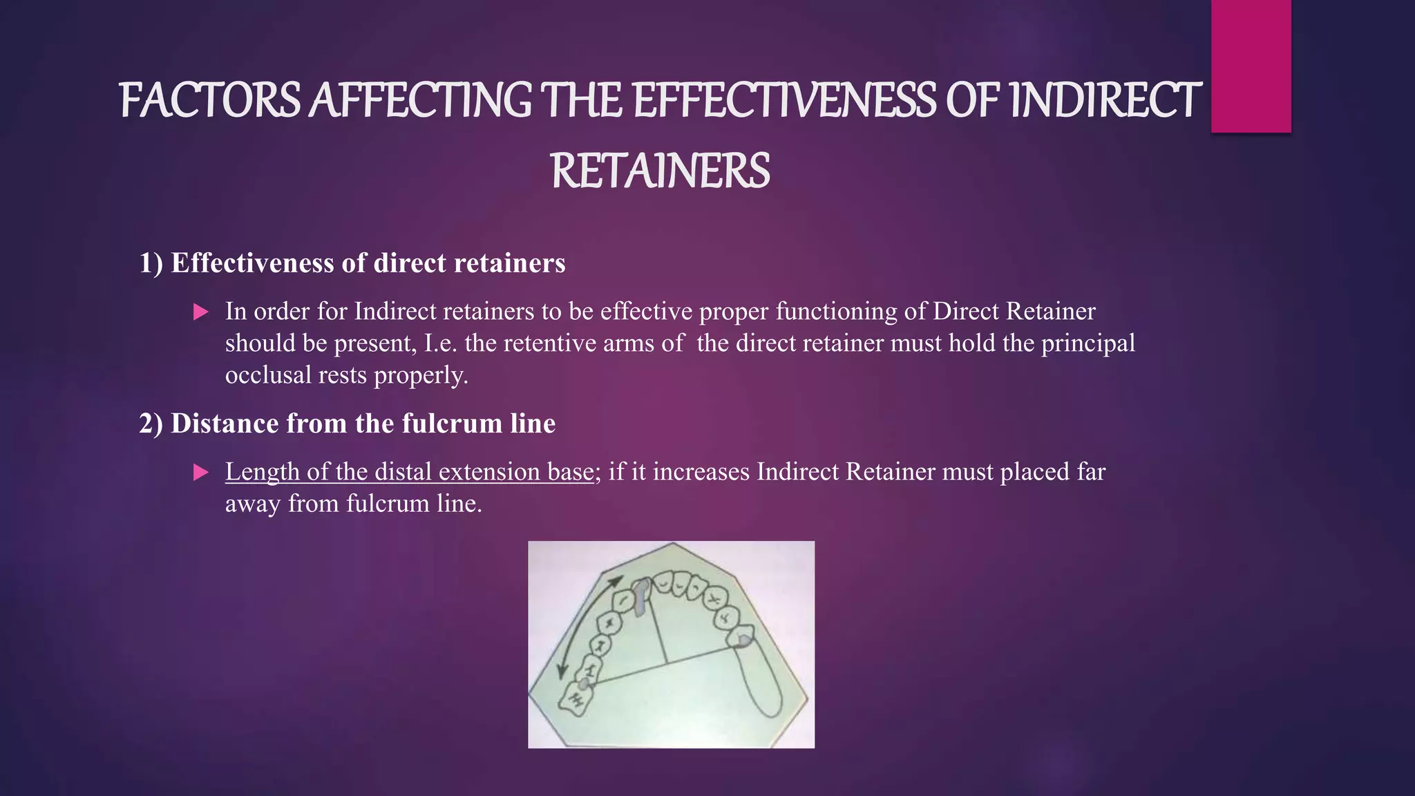 Indirect retainers | PPTX