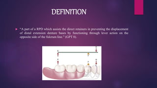 Indirect retainers | PPTX
