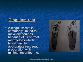 Indirect retainers (2)/ dental courses | PPT