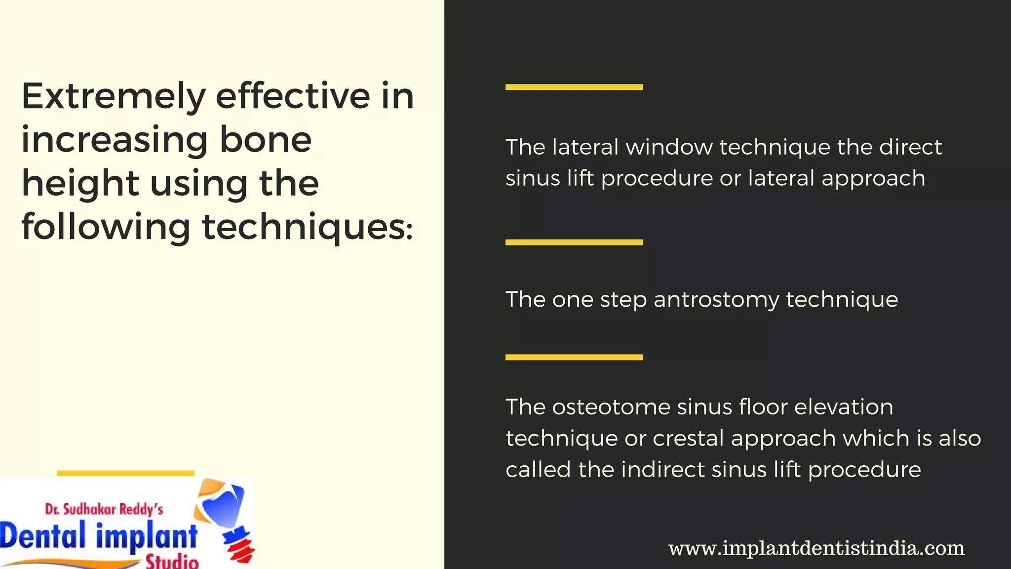 Indirect sinus lift vs Direct sinus lift | PDF