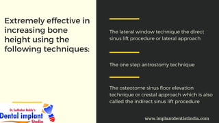 Indirect sinus lift vs Direct sinus lift | PDF