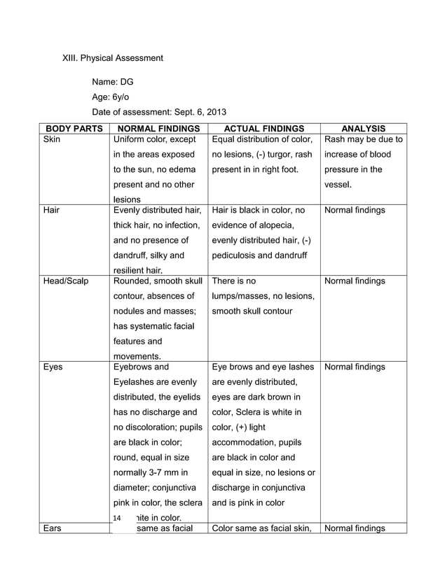 Case study- Dengue Fver | DOC
