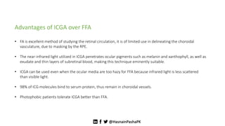 Indocyanine Green Angiography | PPTX